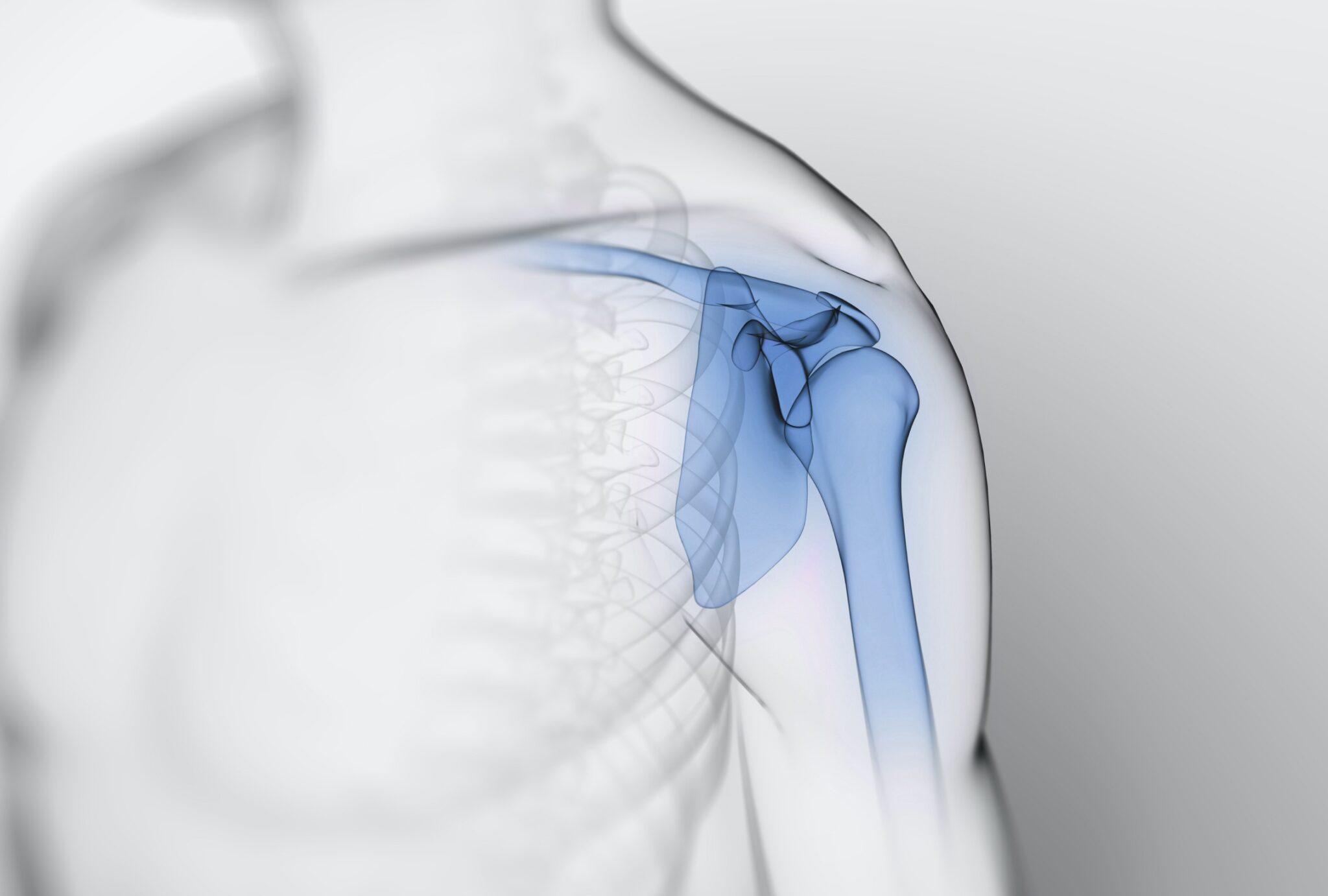 Stabilisation de l'épaule : opération de bankart | Marseille | Dr Salabi